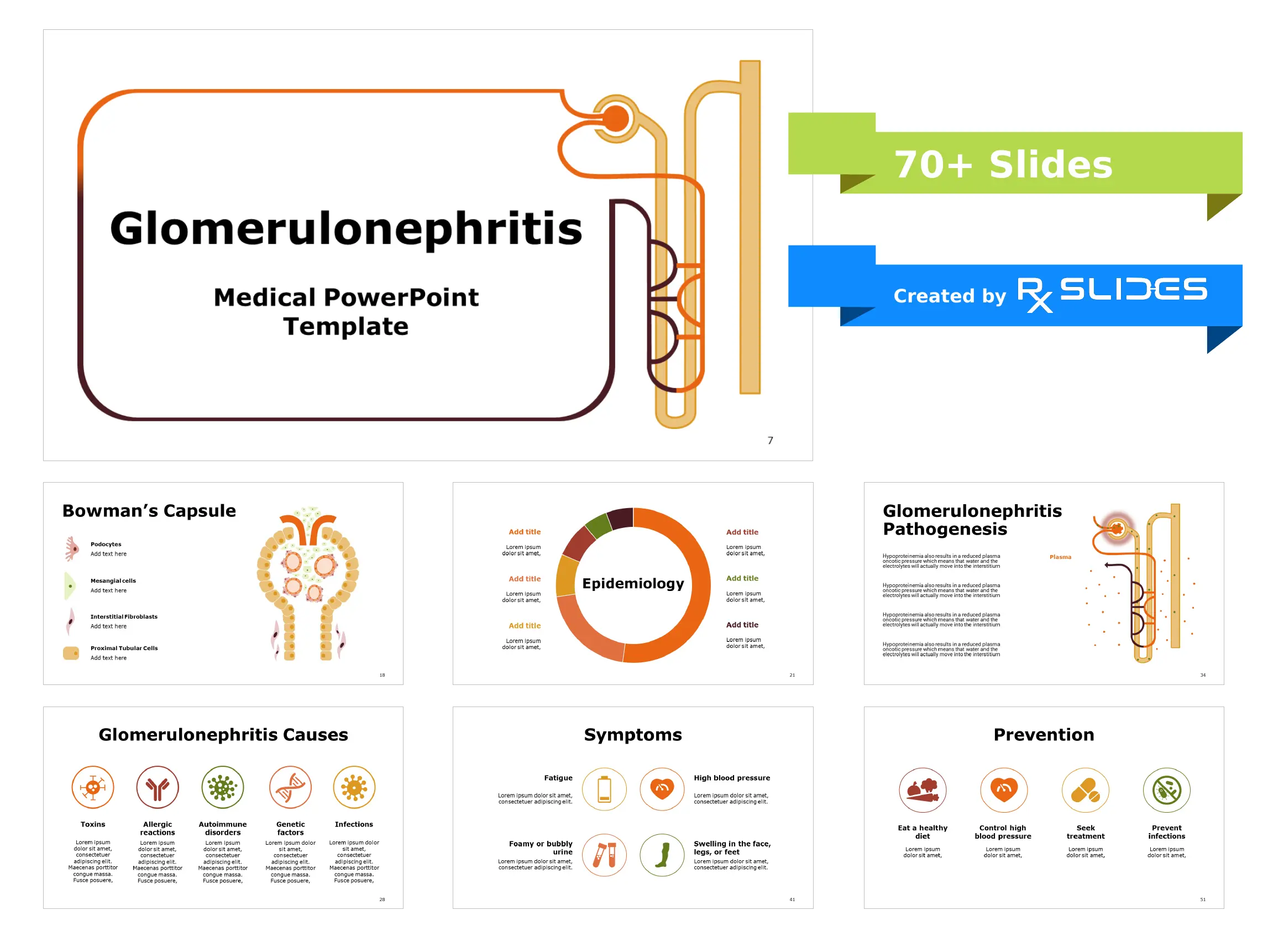 Download Glomerulonephritis PowerPoint Template| RxSlides